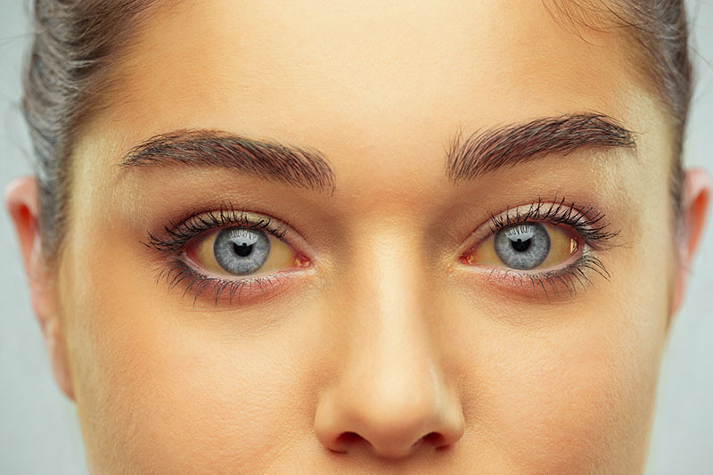 Żółtaczka – przyczyny i objawy - S7HEALTH - Kompleksowa opieka medyczna ...